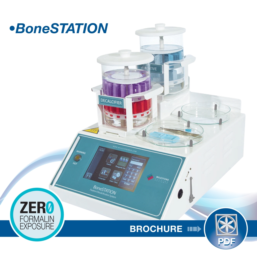 Pre analítica en Patología – Macrosearch | Your single source of ...